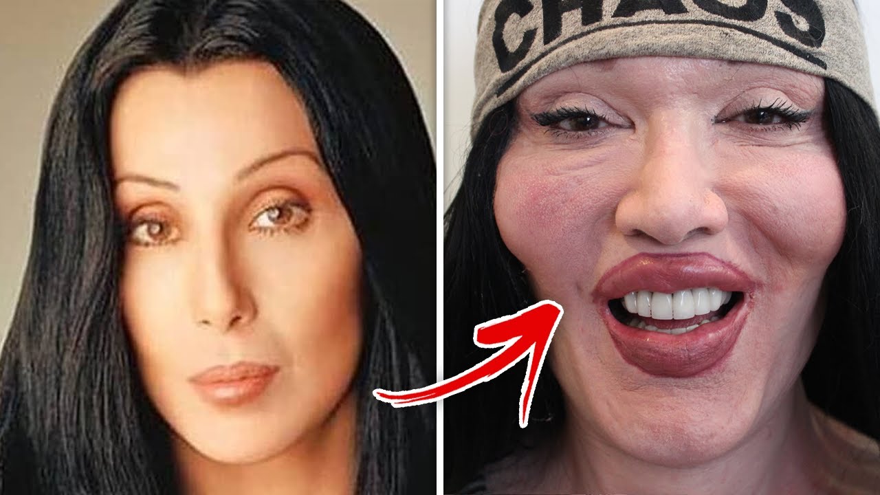 BOTCHED Celebrities Who Destroyed Their Careers With Plastic Surgeries ...