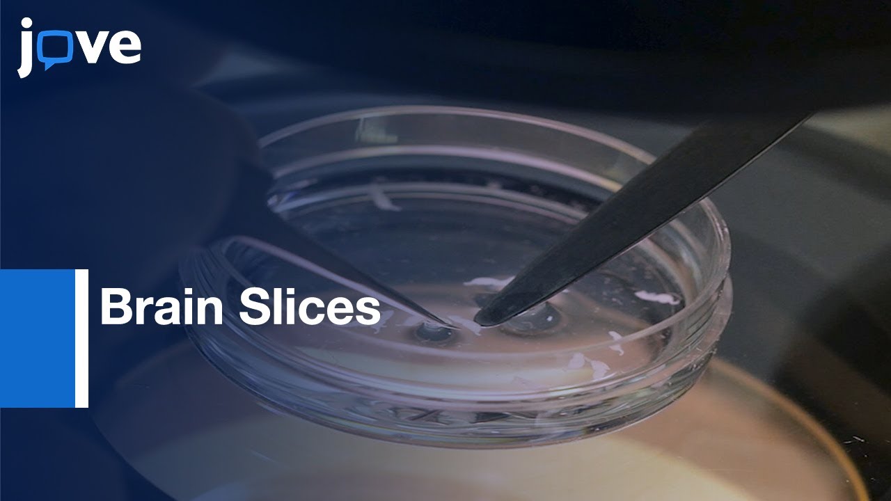 Roller Tube for long-term culture of Brain Slices in Enclosed System ...