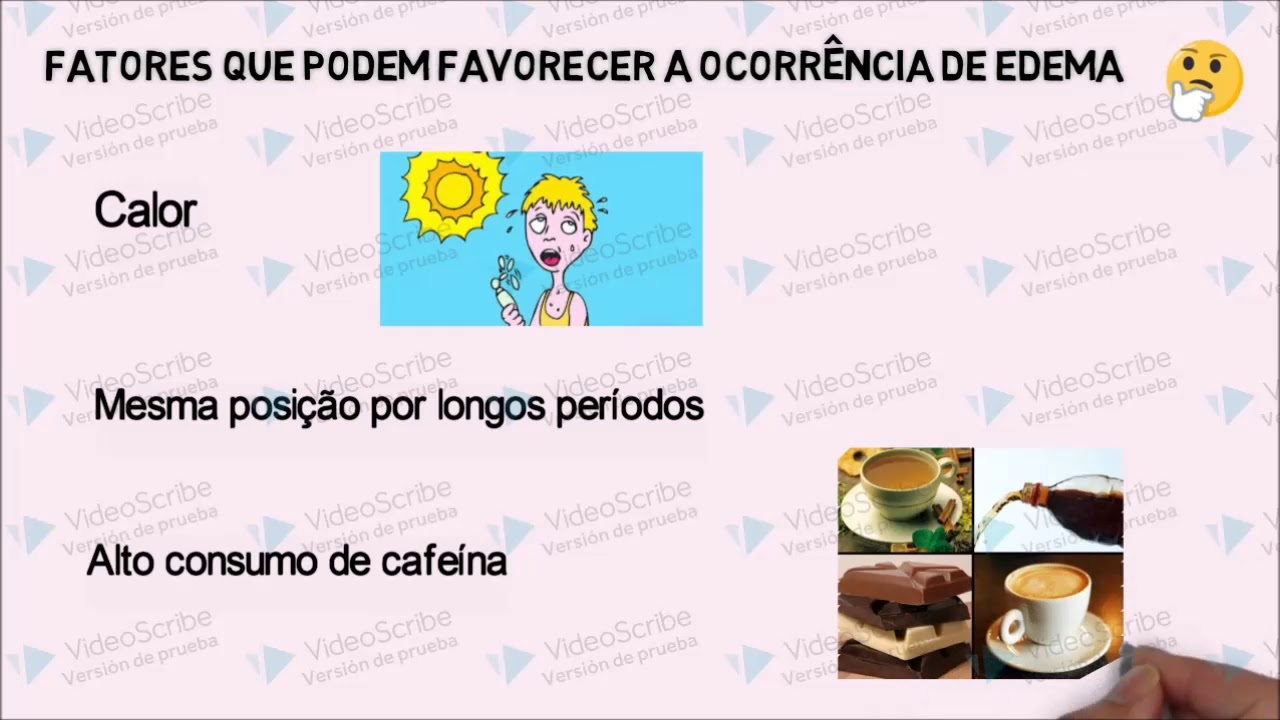 Edema gestacional - YouTube