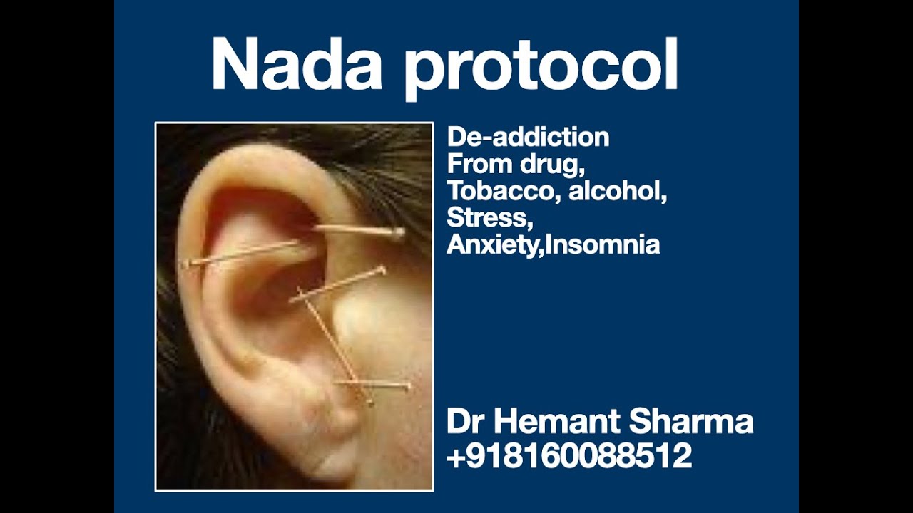 DAY 3 HINDI ACUPUNCTURE PROTOCOL FOR DE ADDICTION, NADA PROTOCOL FOR DE ...