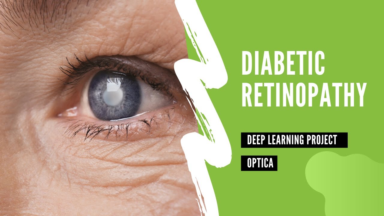 Diabetic Retinopathy |Deep Learning Project |Let’s diagnosis this ...