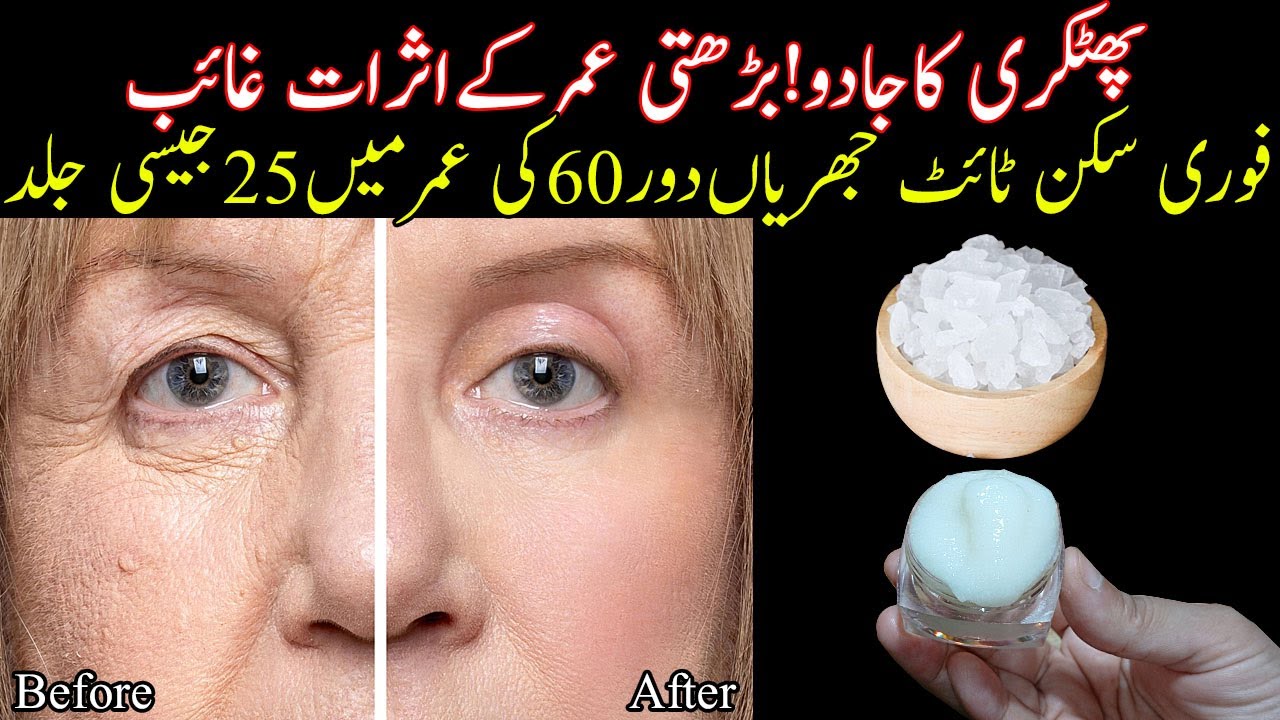 Alum Cream Magic Remove Wrinkles In Just Three Days|Shrink Open Pores ...