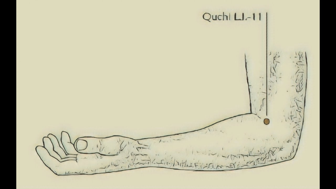 Точка от гипертонии QuChi, 曲池, LI11, как ставить иглу - YouTube