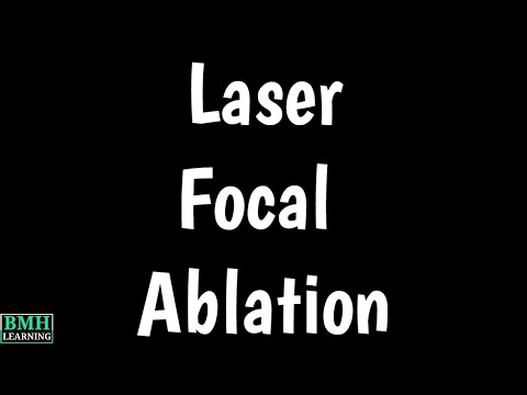 Focal Laser Ablation | Focal Laser Ablation for BPH | - YouTube