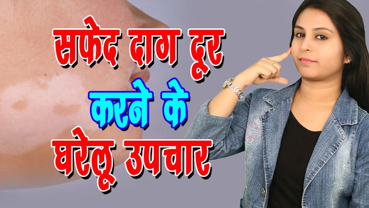 सफ़ेद दाग दूर करने के घरेलू उपचार Safed Daag Ka Gharelu Ilaj ...