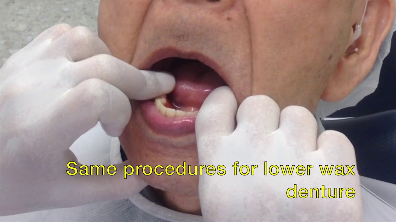 How to check tooth position - YouTube