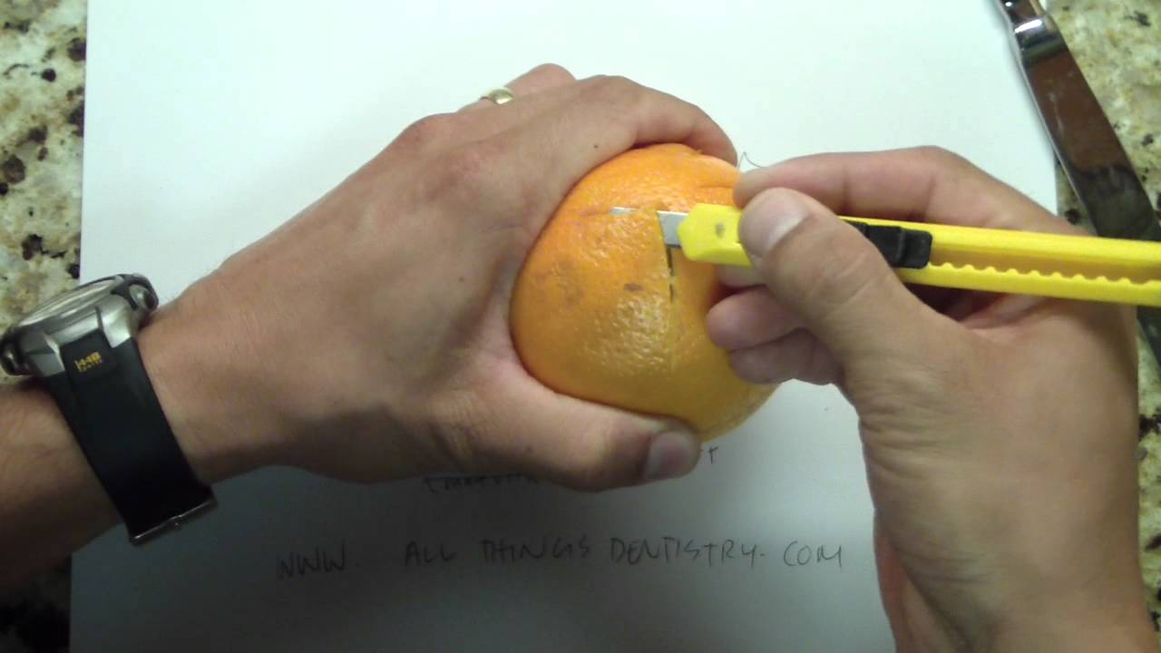 Practice Harvesting Connective Tissue from the Palate - YouTube