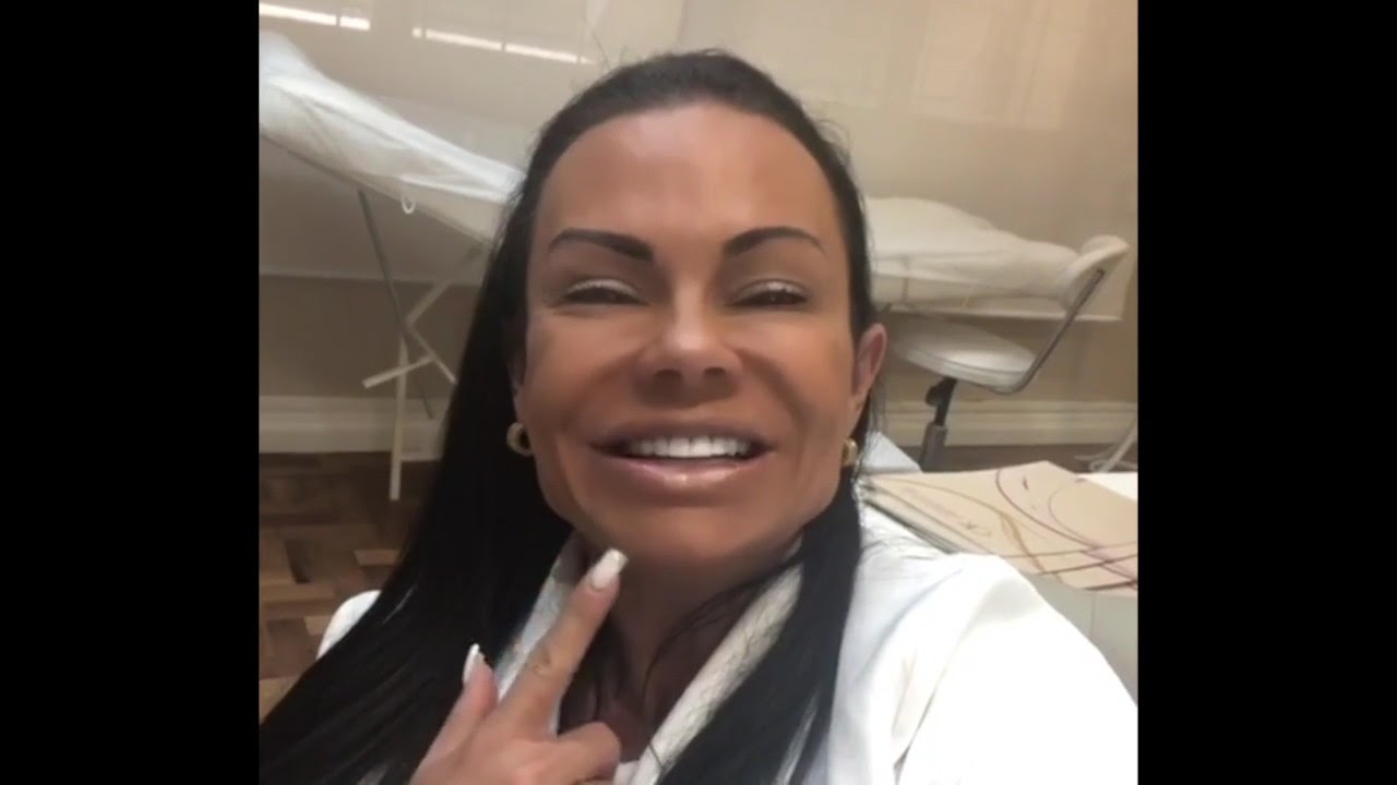 Transformando Sorrisos - Evelise Scherer - YouTube