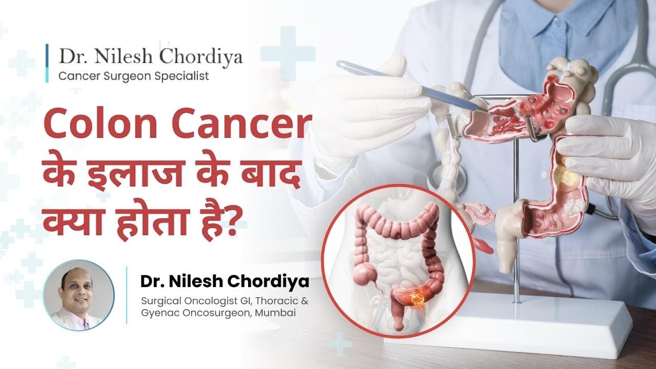 Colon Cancer के इलाज के बाद क्या होता है? | Colon Cancer: Complications ...