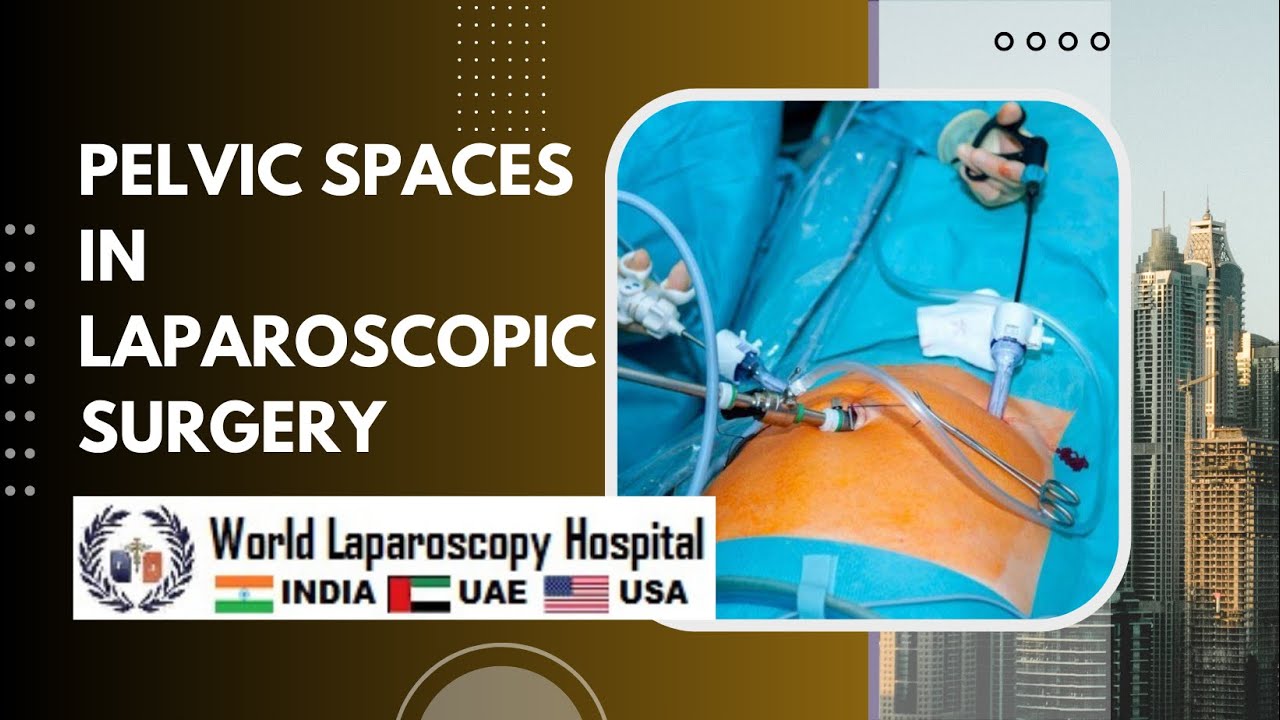 Mastering Pelvic Spaces in Laparoscopic Surgery | Step-by-Step Surgical ...