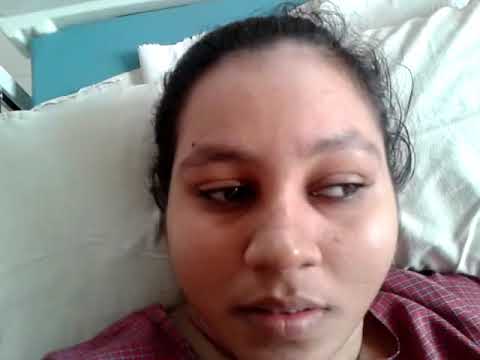 INO internuclear ophthalmoplegia video - YouTube