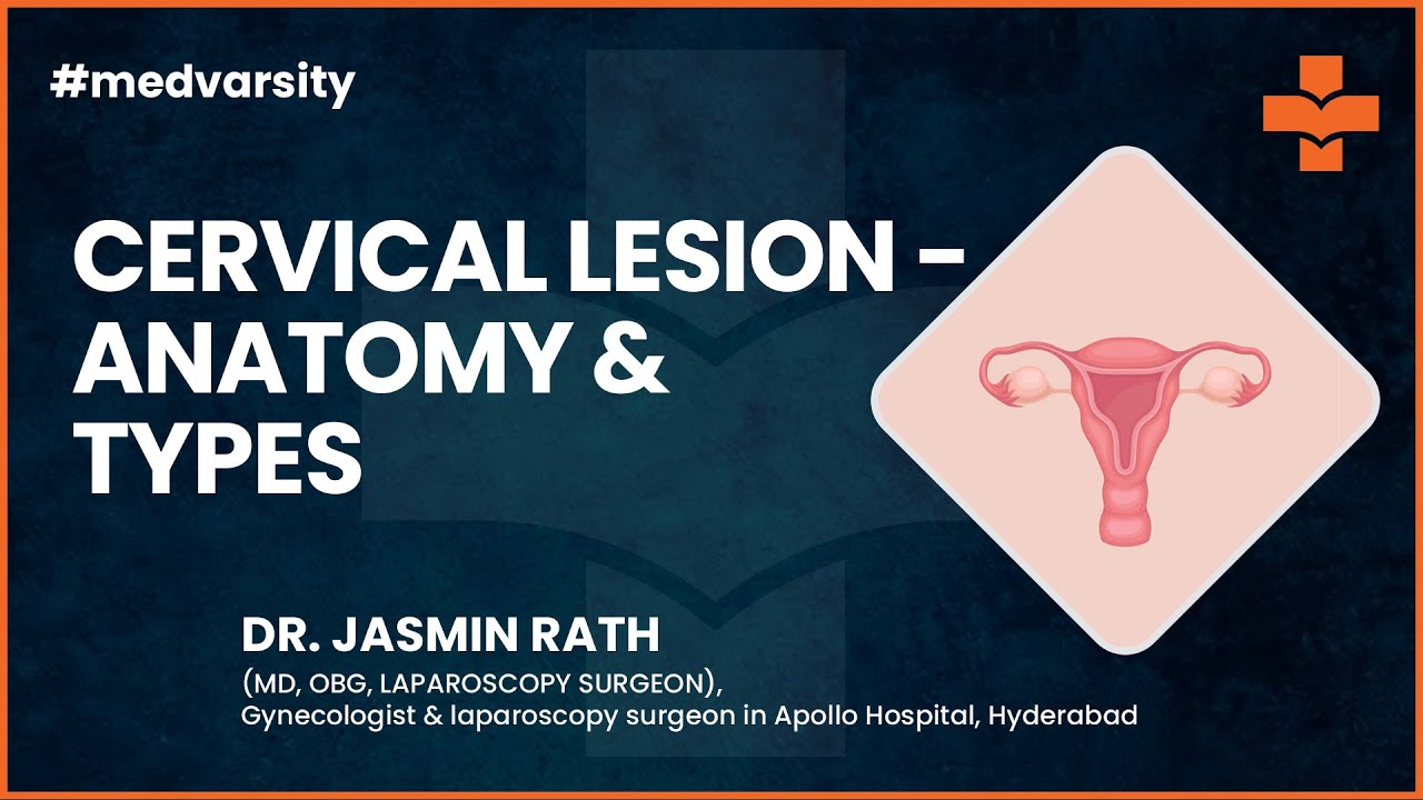Case Discussion on Cervical Lesion - Anatomy & Types ...
