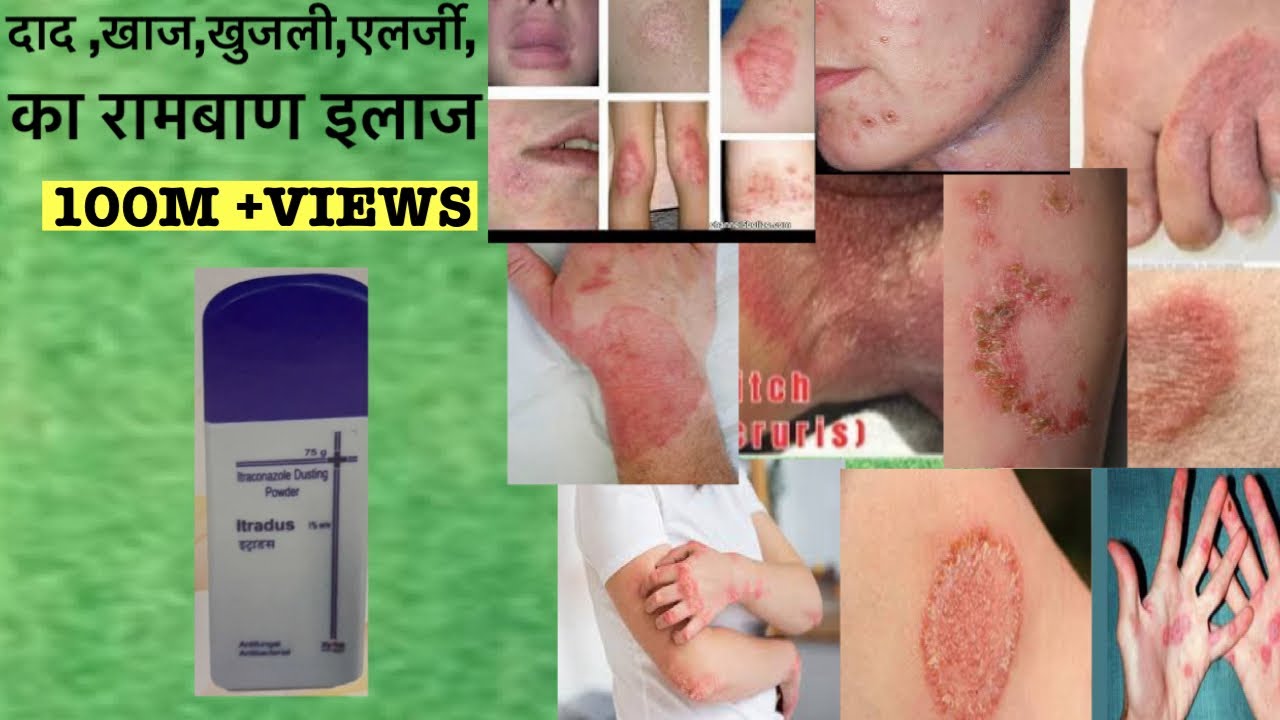 Itradus powder uses | price | composition | dose | side effects ...