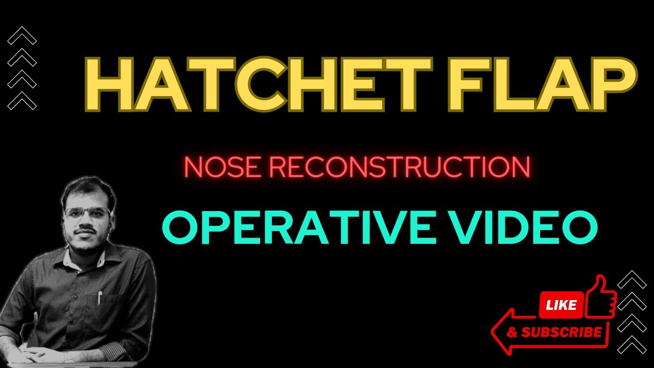 HATCHET FLAP | LOCAL FLAP NOSE RECONSTRUCTION - YouTube