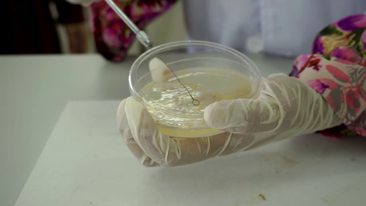Experiment 7: Diversity of Bacteria - YouTube