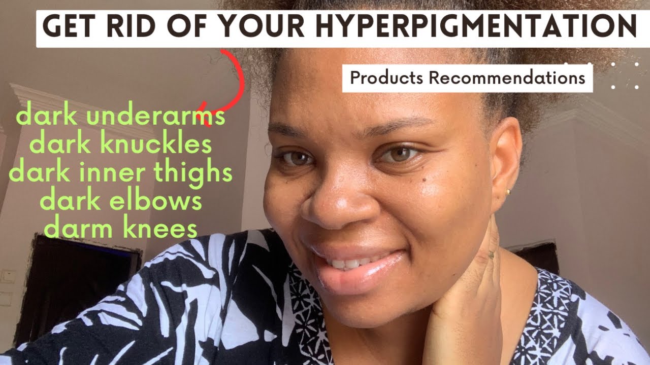 how to fade hyperpigmentation quickly + ROUTINE SKINCARE PRODUCTS ...