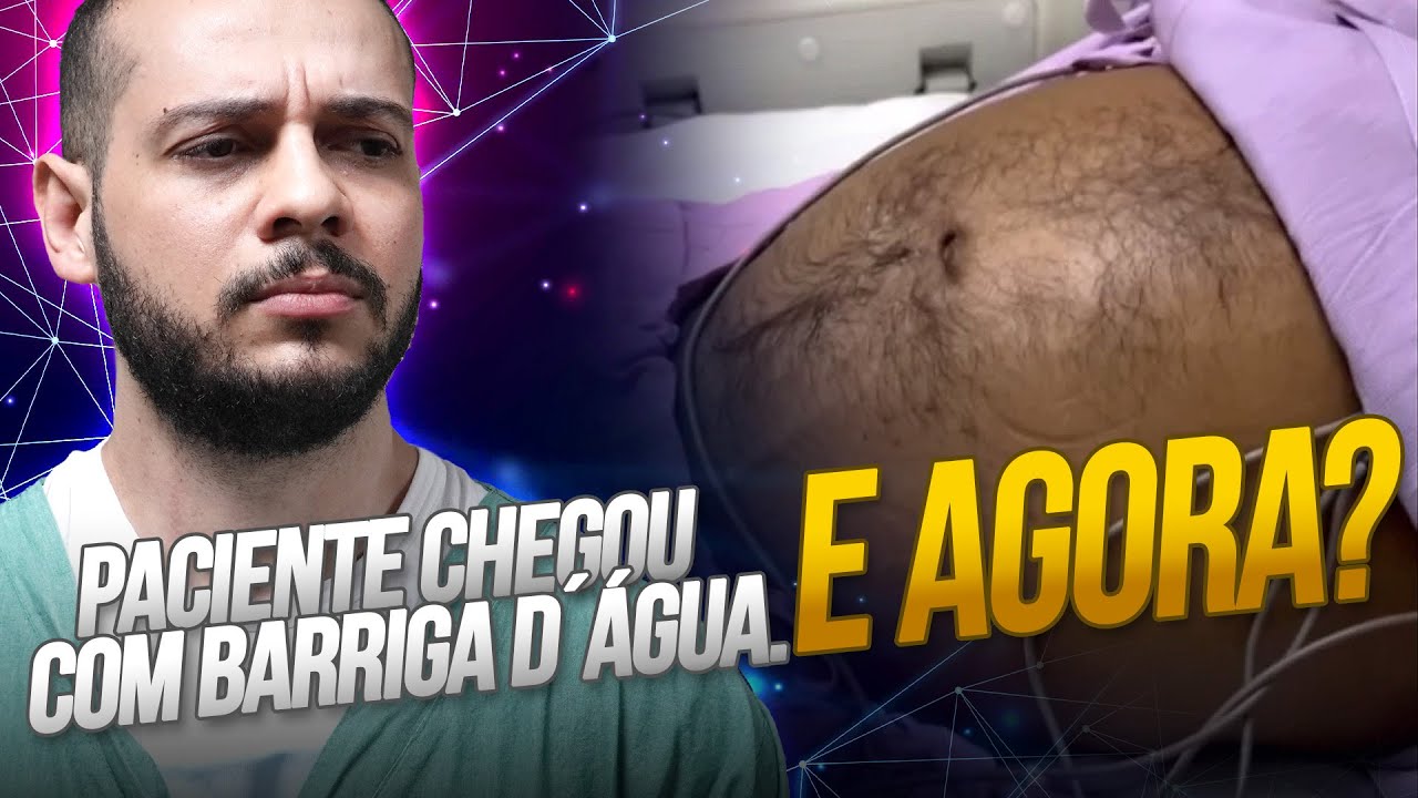 Paracentese: entenda como funciona a retirada de líquido abdominal em ...