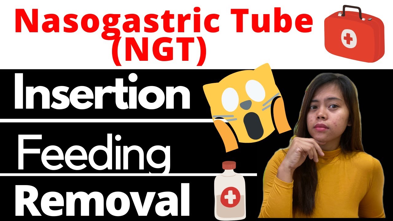 NGT Insertion, Feeding & Removal Return Demonstration I Student Nurse ...
