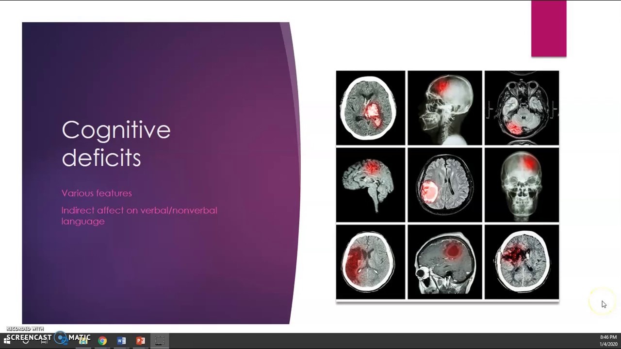 Cognitive deficits - YouTube
