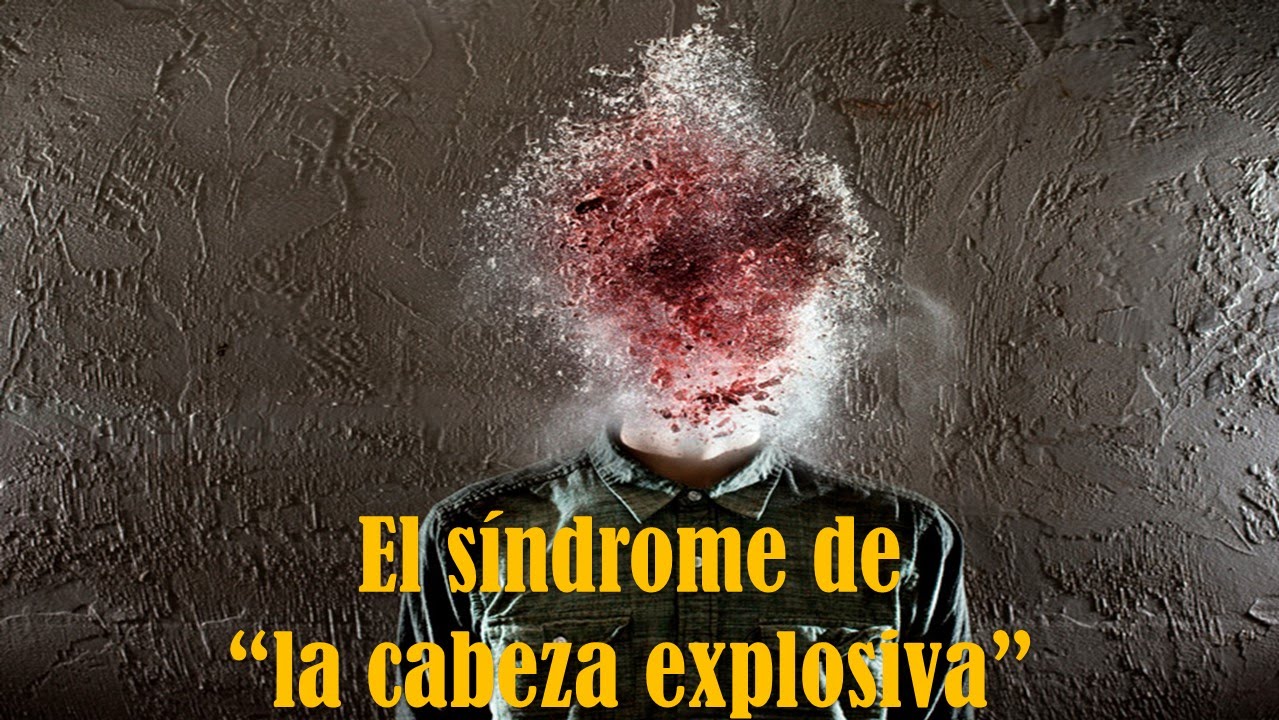 El escalofriante "Síndrome de la cabeza explosiva" es real - YouTube