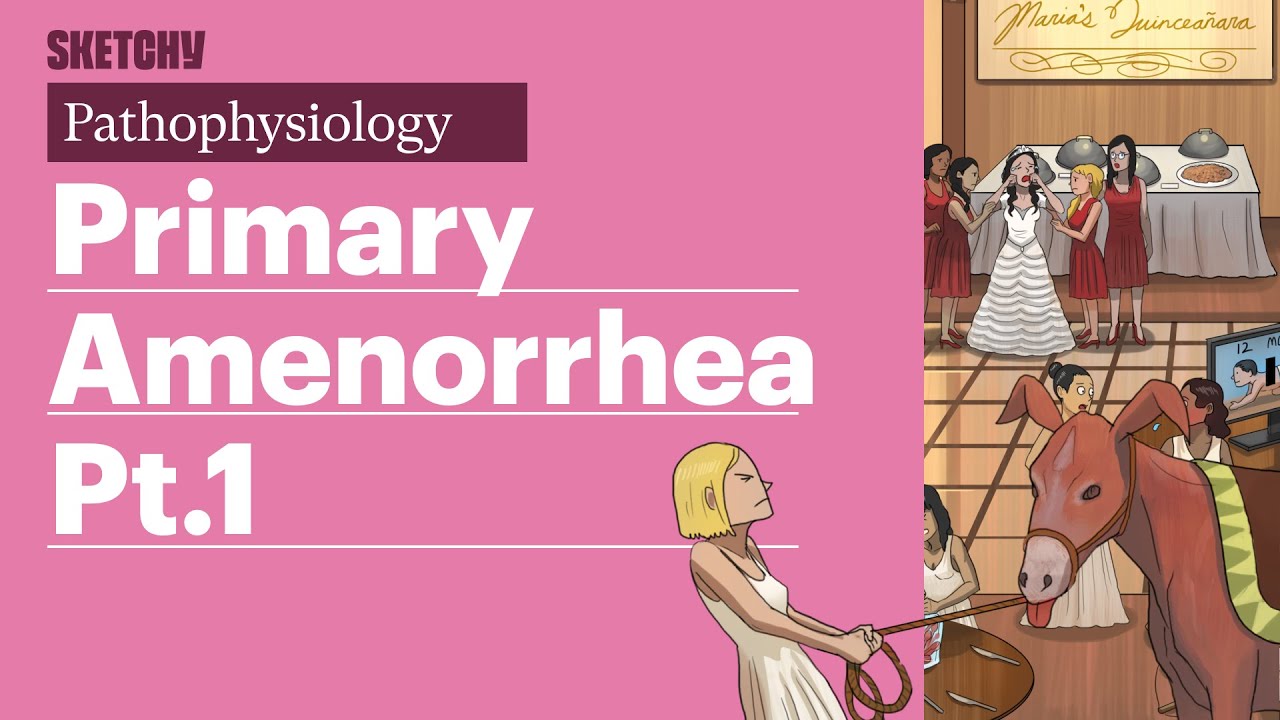 Amenorrhea: Pathophysiology (Part 1) | Sketchy Medical | USMLE Step 1 ...