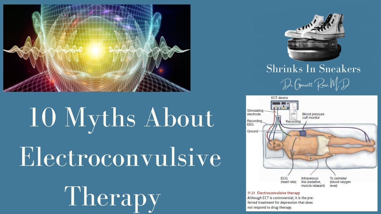 Electroconvulsive Therapy Diagram