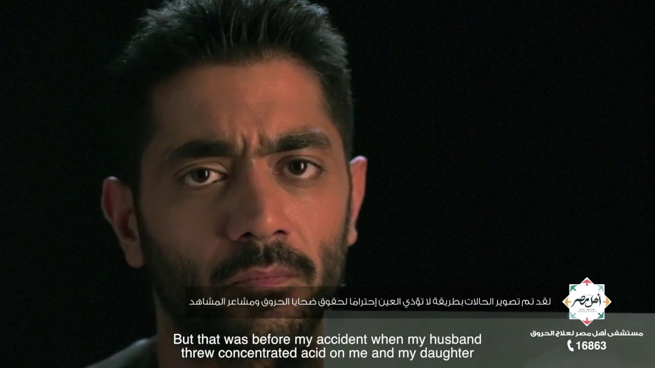Stories Behind Burn Survivors - Ahmed Falawkas كل حالة حروق وراها قصة ...