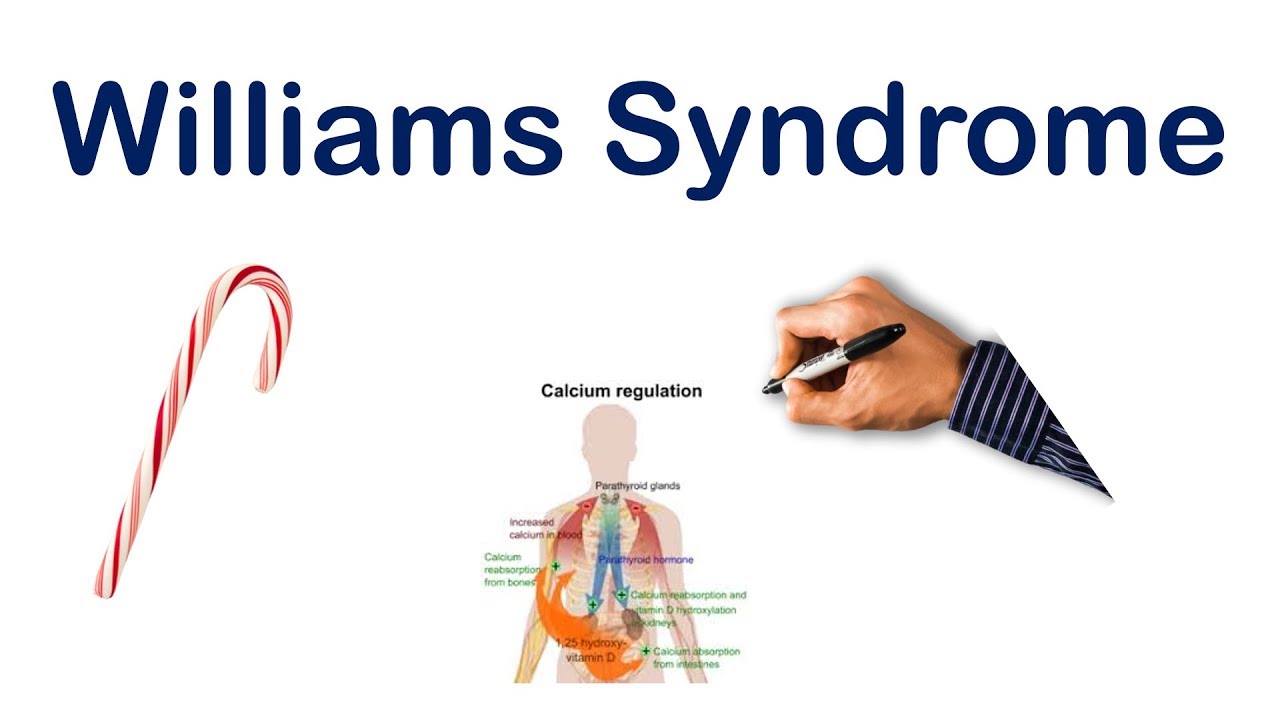 Williams Syndrome Easy Mnemonic USMLE STEP COMLEX NCLEX YouTube williams-syndrome-easy-mnemonic-usmle-step-comlex-nclex-youtube