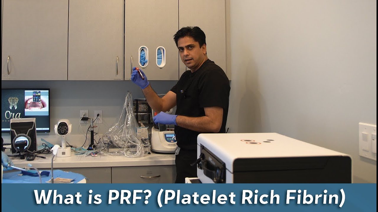 Why Do I Need PRF After Tooth Extraction? | The Benefits of Platelet ...