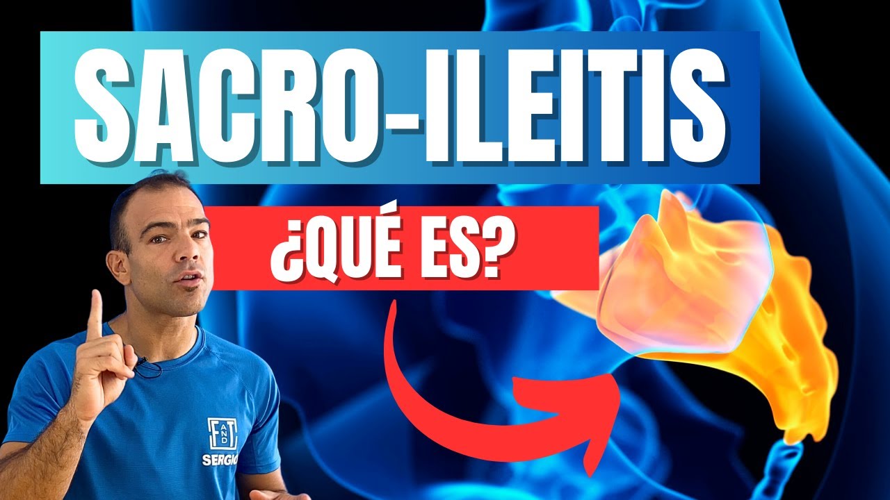 ¿Qué es la SACROILEITIS?👉🏻CAUSAS Y SINTOMAS👈🏻¿Cómo solucionar el DOLOR ...