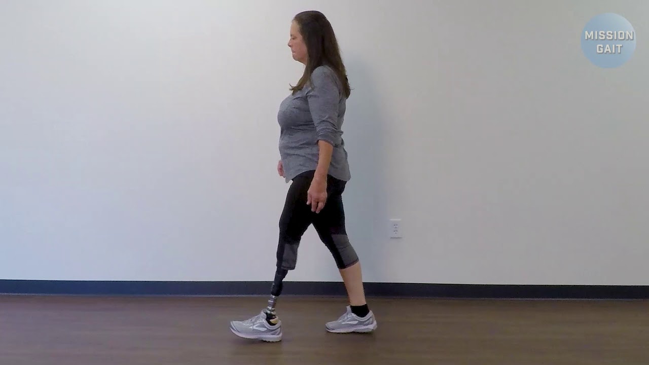 Above-Knee Amputee Gait - Case Study 22 - YouTube