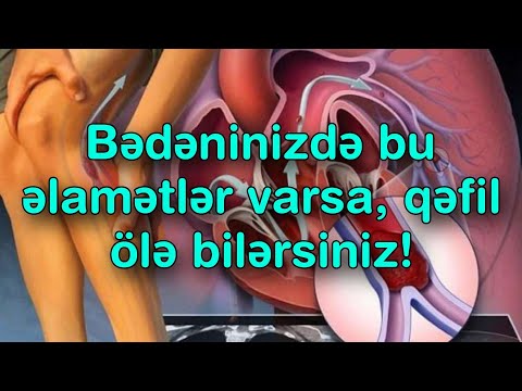 Bədəninizdə bu əlamətlər varsa, qəfil ölə bilərsiniz