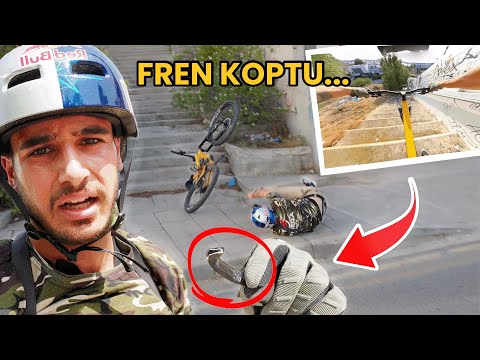 Frenim Kırıldı… En Kötü Kazalarımdan Biri!
