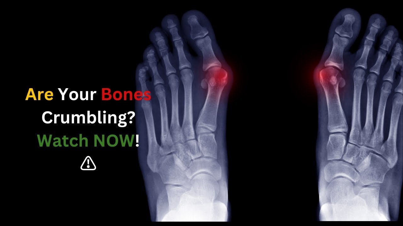 7 Shocking Signs Your Bones Are Weakening After 80—And How to Stop It ...