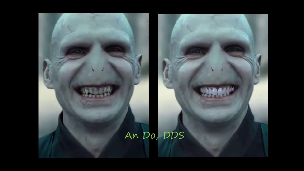 Digital Smile Design for Voldemort! - YouTube