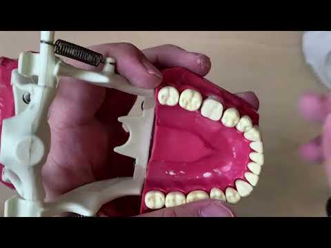 Alt Çene 1.Molar Diş Preparasyonu I Tooth Preparation I Mandibular First Molar