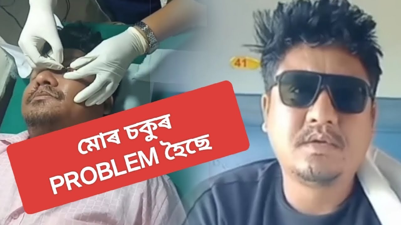 MISING ACTOR || BABA DOLEY ৰ চকুৰ PROBLEM PLEASE HELP 🥲 - YouTube