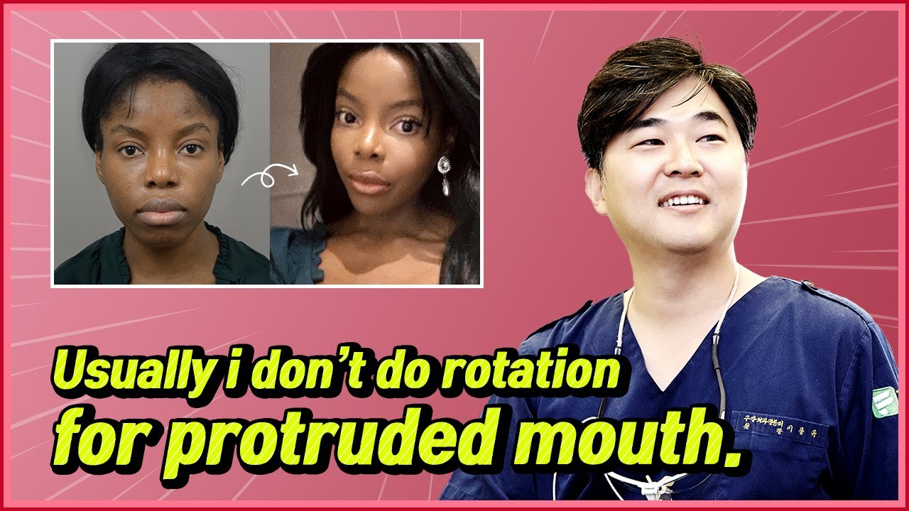 Maxillary Protrusion