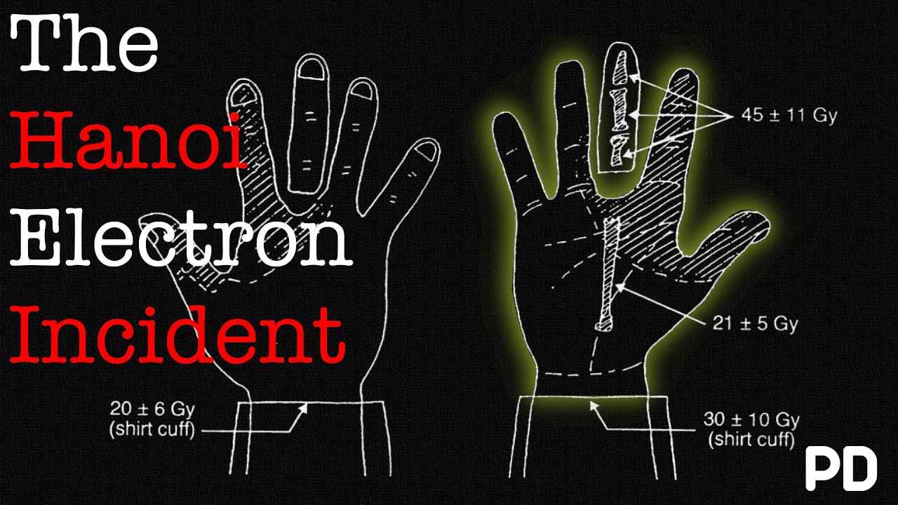 A Brief History of: The Hanoi Electron Accelerator Accident ...