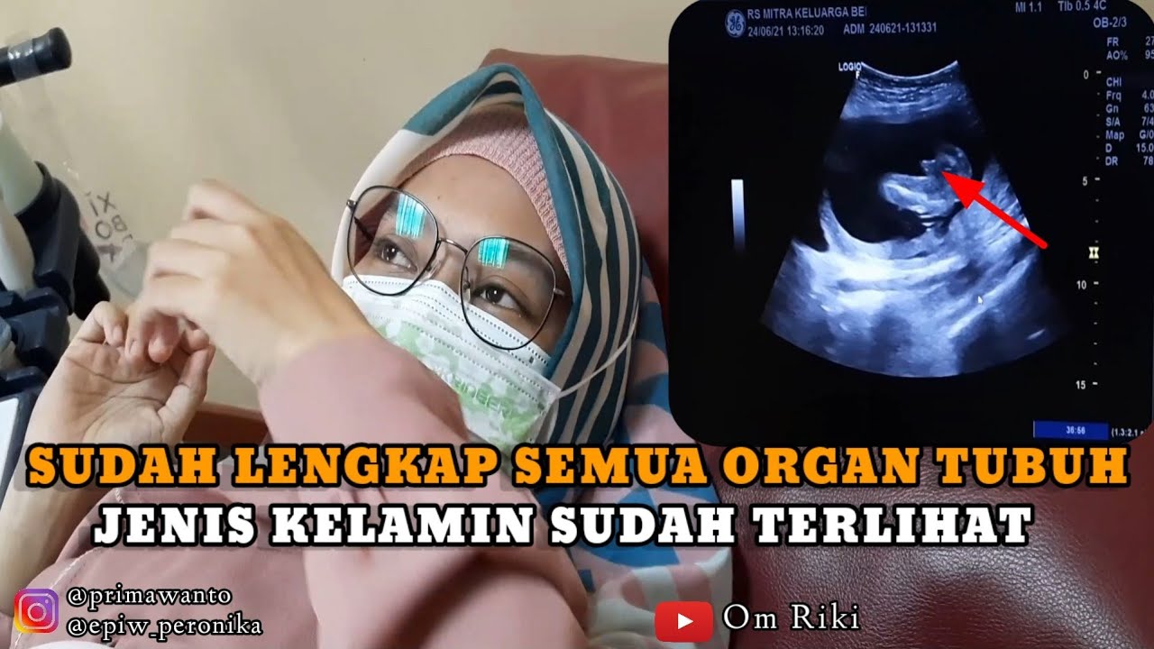 USG 2D 18 Minggu || USG 2 Dimensi 5 bulan || Ultrasonography Pregnancy ...