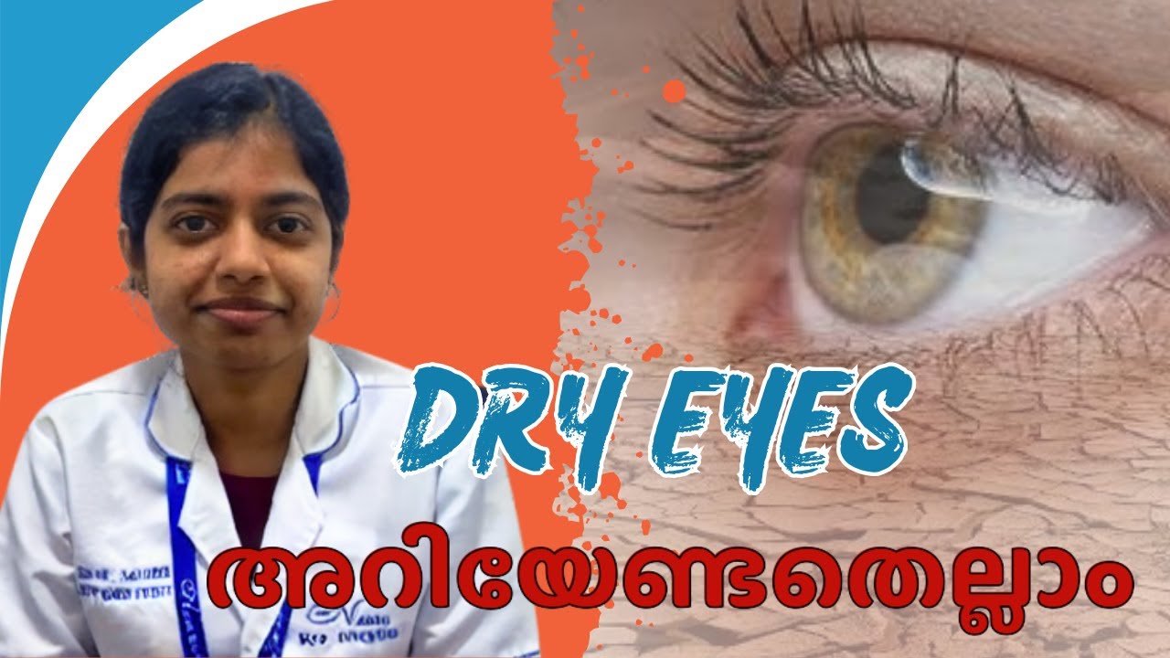 എന്താണ് വരണ്ട കണ്ണുകൾ | DRY EYE | MALAYALAM EXPLANATION - YouTube