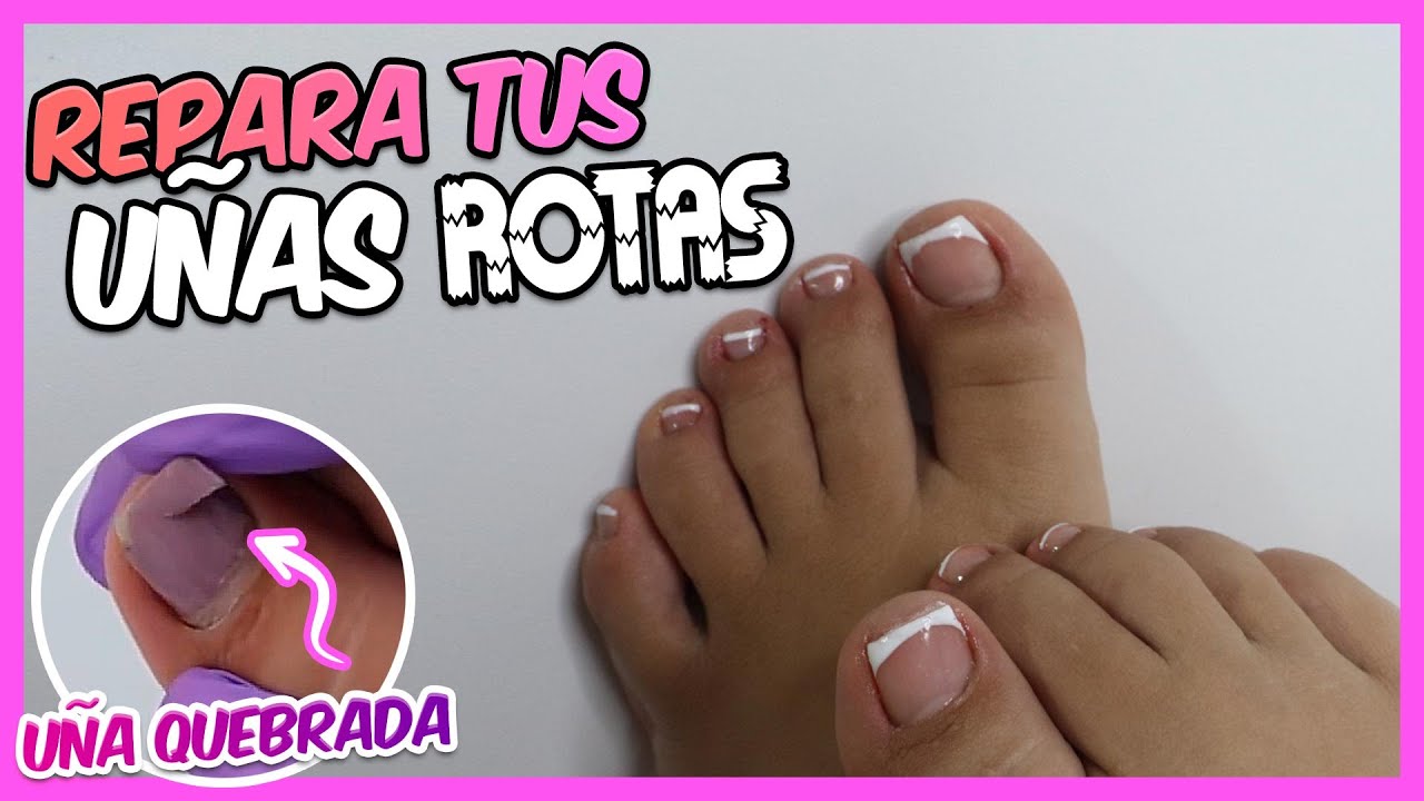 ¿Cómo REPARAR una UÑA ROTA o QUEBRADA del PIE? 💔 La Manera MÁS FÁCIL 💜💅 ...
