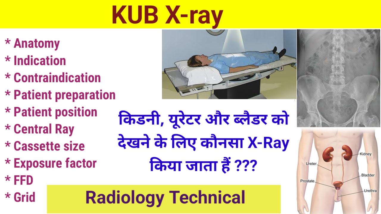 KUB X-ray # Patient position # Kidney # ureter # Bladder #urinarytract ...