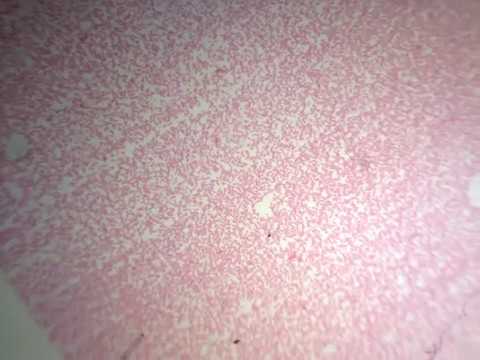 globules rouge : vue microscopique - YouTube