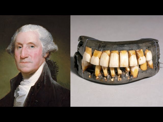 George Washington Gold Teeth