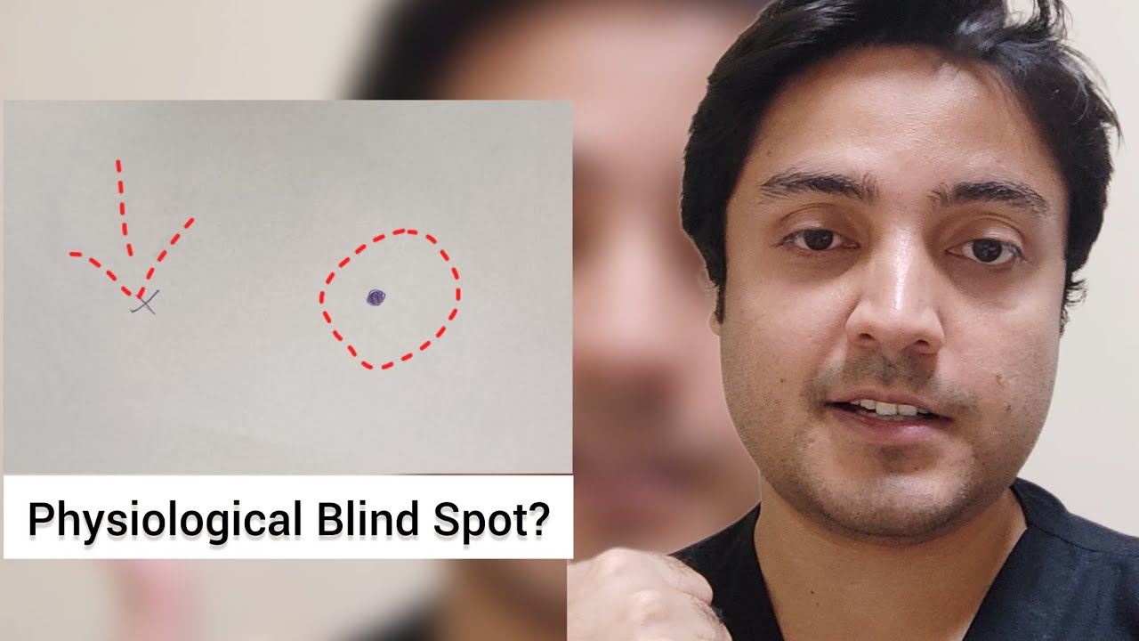 Physiological Blind Spot | Cause Explained 👁️ - YouTube
