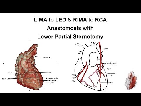 Lima to lad : Vidbb.com - music search engine