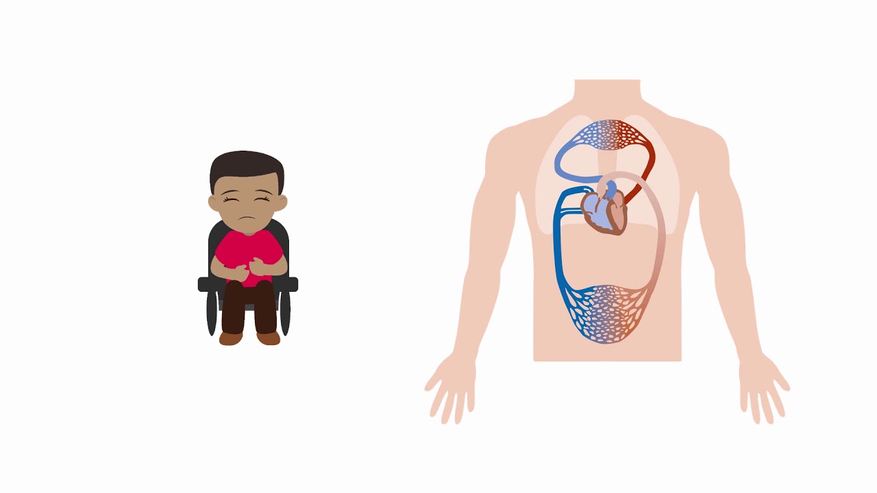 Managing mixed shock states - YouTube
