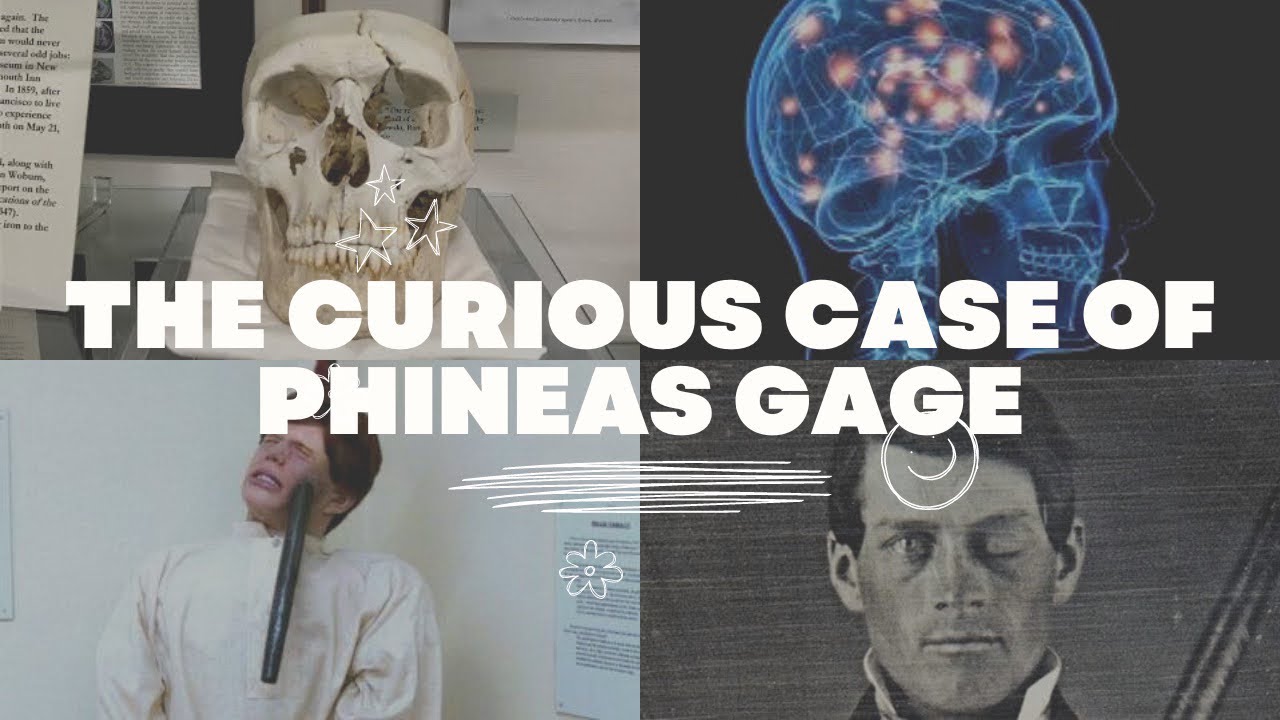 The Curious Case Of Phineas Gage - YouTube