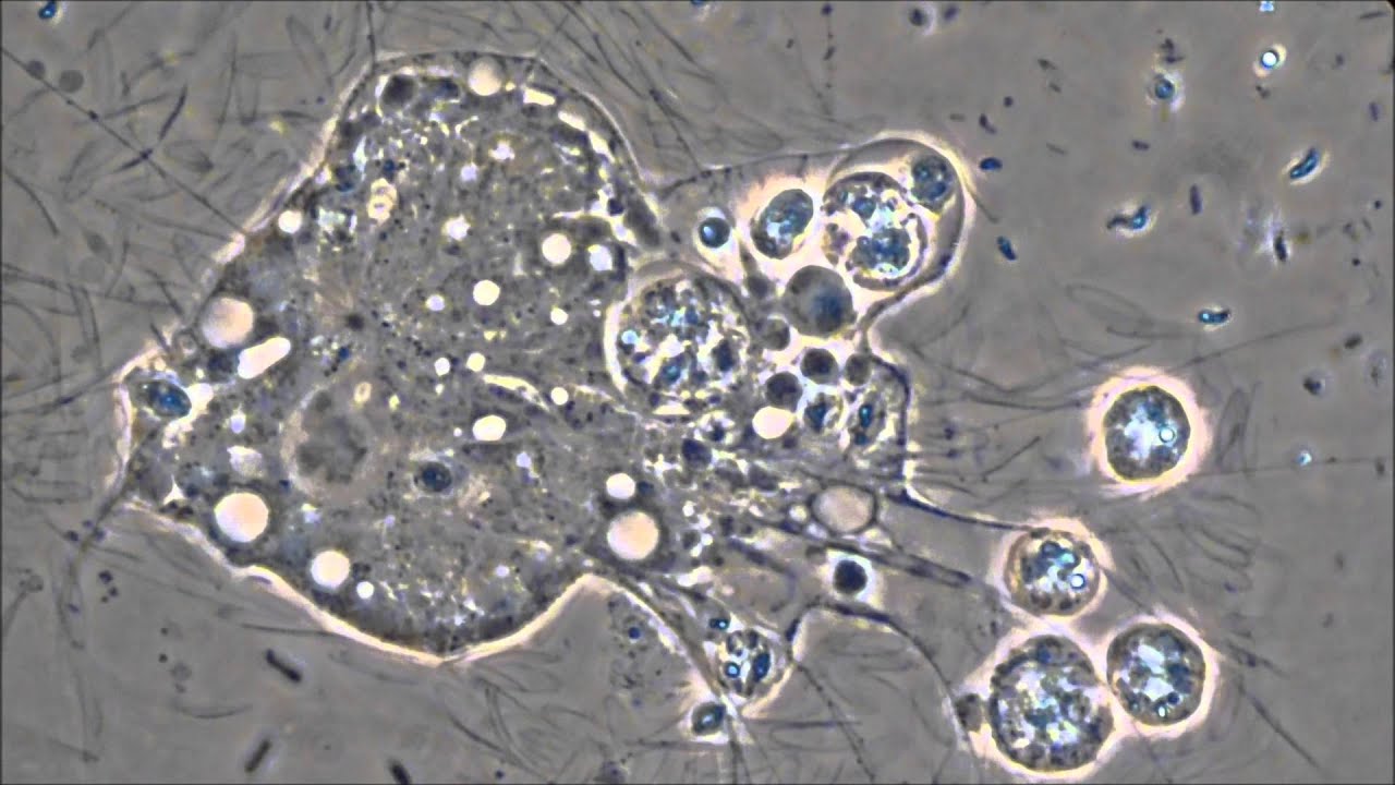 Rhizaria Microscopy - YouTube